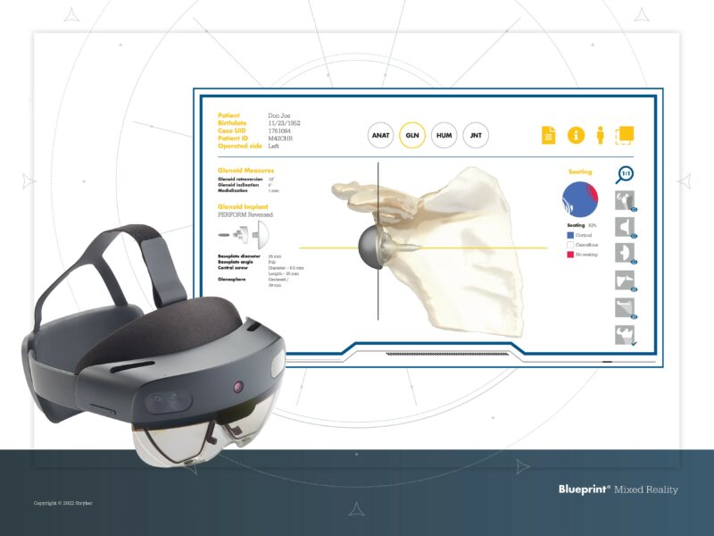 What’s Driving Today’s Shoulder Replacement Growth? - BONEZONE