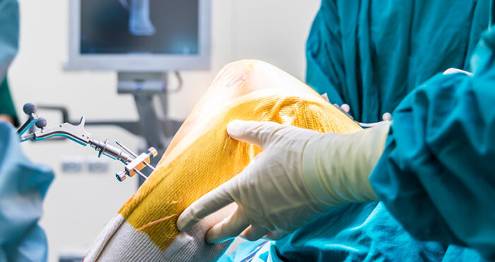 Orthopedic Device Designs Are Focused on Minimally Invasive Solutions