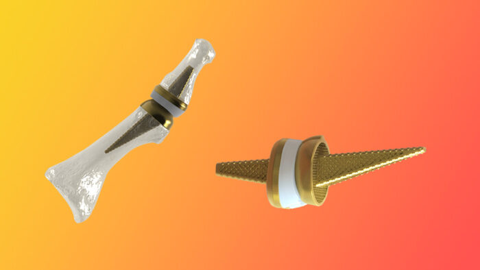 FDA 510(k) Submission for First 3D-Printed Toe Joint Replacement
