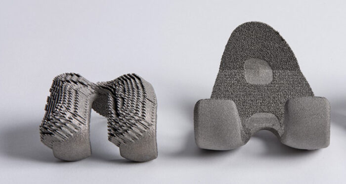 New Implant Designs Capitalize on the Cementless Knee Movement