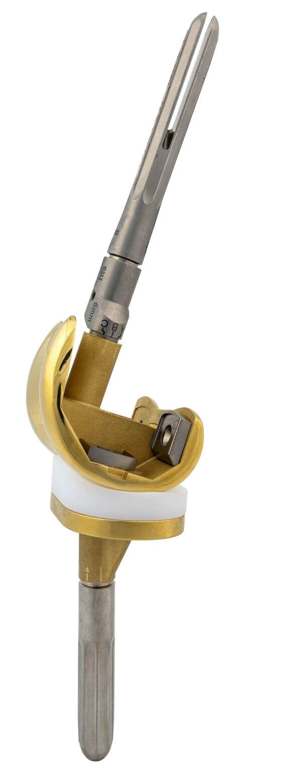 The Latest Trends in Knee Replacement Implant Design - BONEZONE