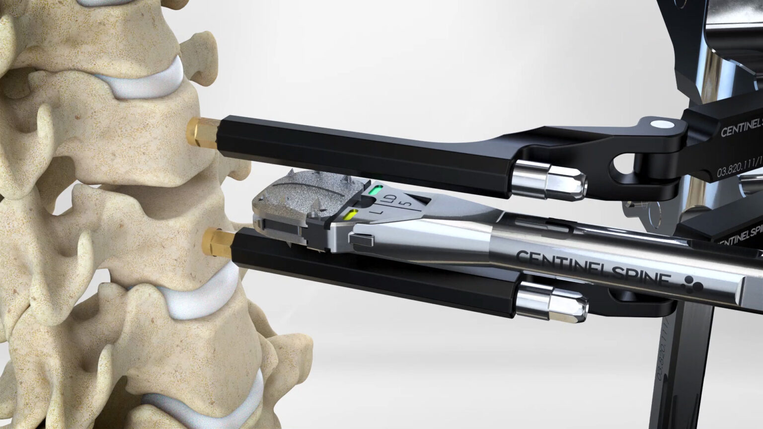 Betting on the Proven Benefits of Motion Preservation - BONEZONE