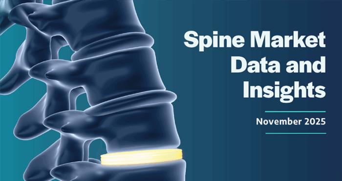Spine Market Data and Insights 2025 - BONEZONE